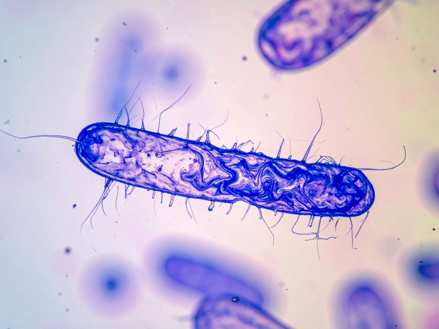 Bacterias: qué son, características, estructura, tipos y ejemplos ...