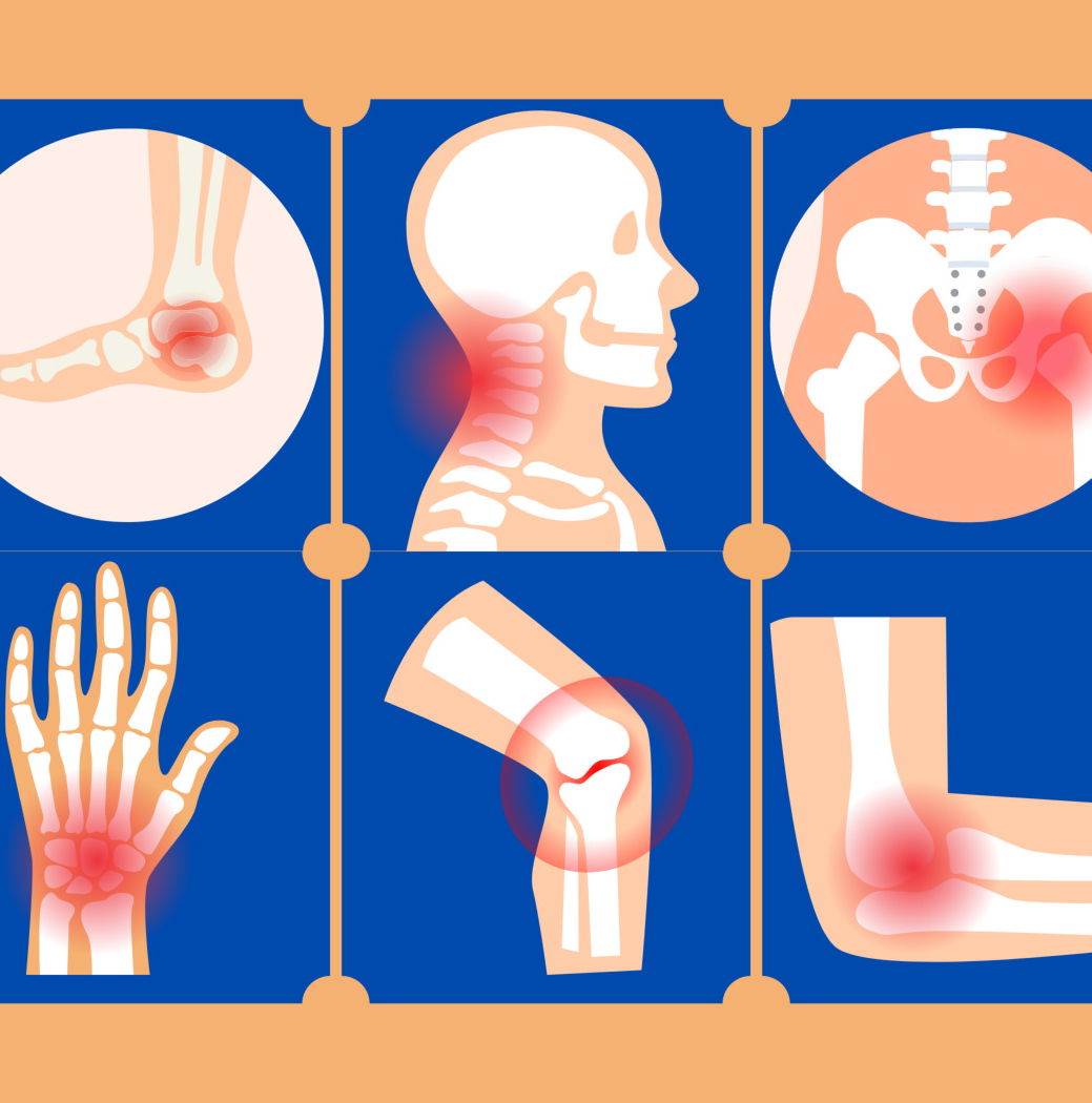 Tipos De Articulaciones Y Ejemplos Tipos De Articulaciones – Artofit